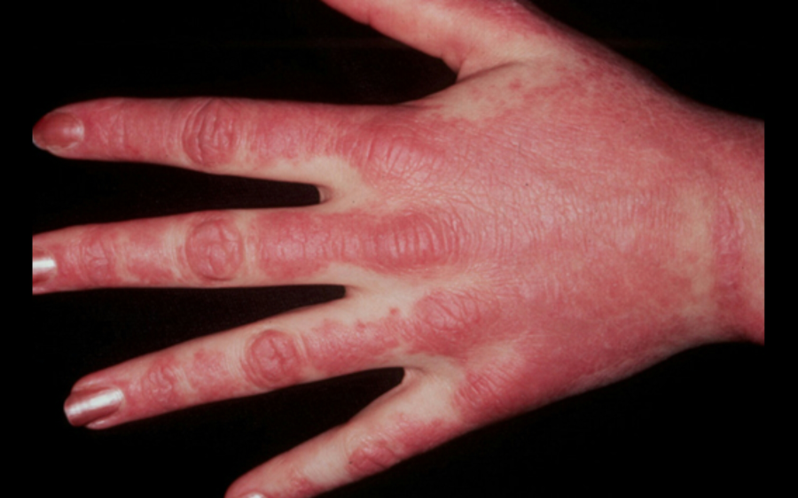 Semen Allergy Sends Woman To Hospital After Co Worker Contaminates Her